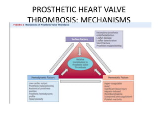 Prosthetic valve thrombosis | PPT