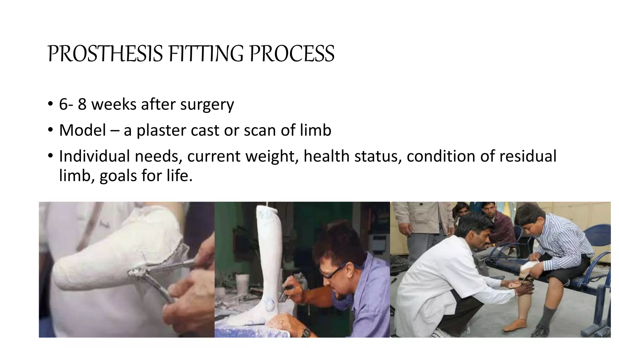 Prostheis care | PPTX