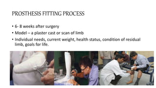 Prostheis care | PPTX