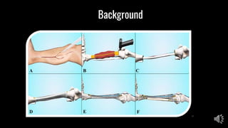 Tibial Prosthesis Biomaterials: Co-Polymers & Optimizing Properties | PPT