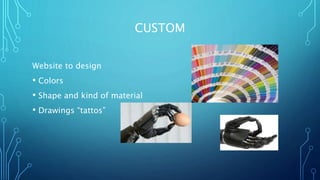 Prosthesis | PPT