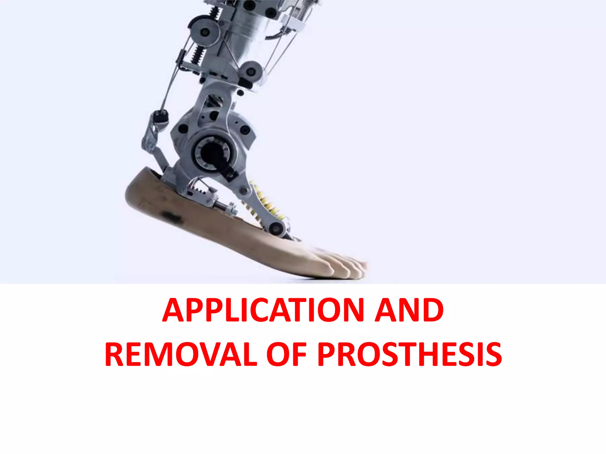 Prosthesis | PPTX