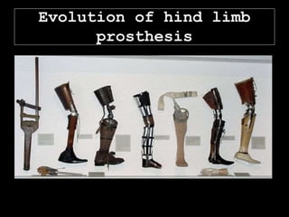 Prosthesis | PPTX