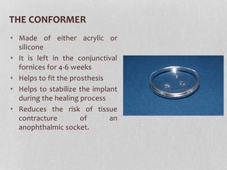 Ocular Prosthesis | PPTX