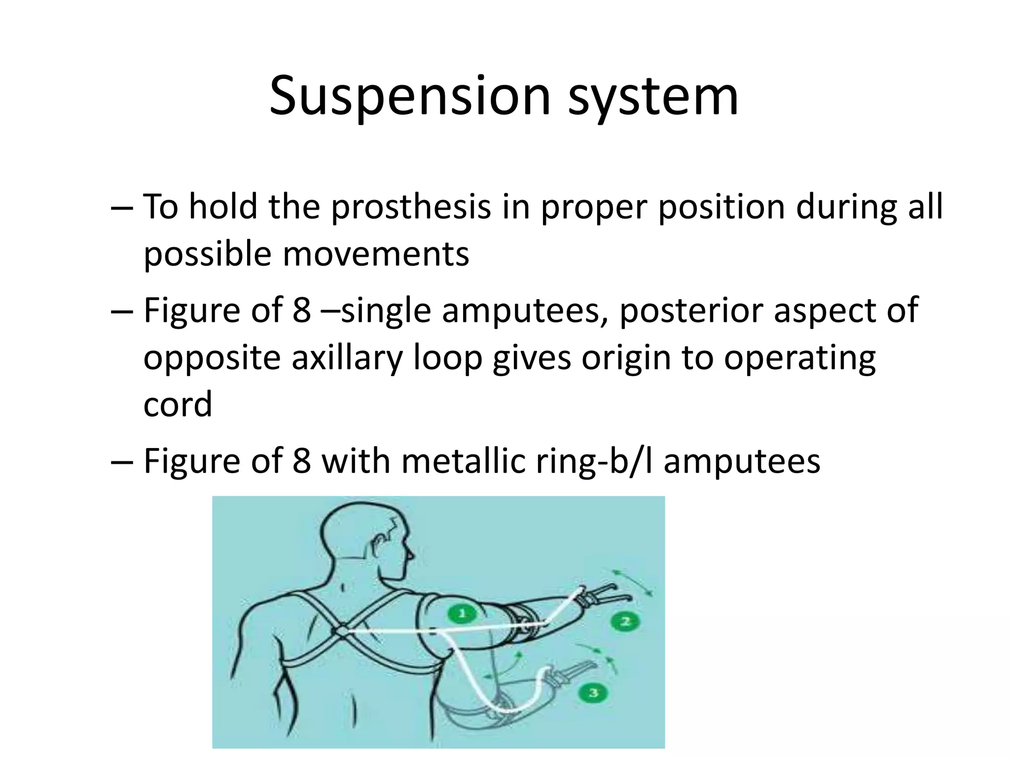 Prosthesis principle | PPTX