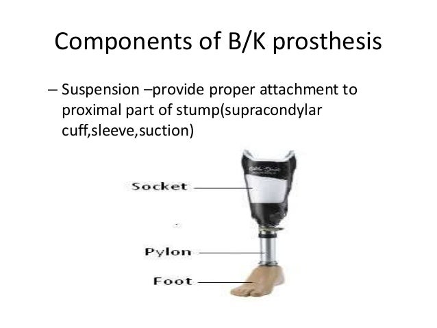 Prosthesis principle
