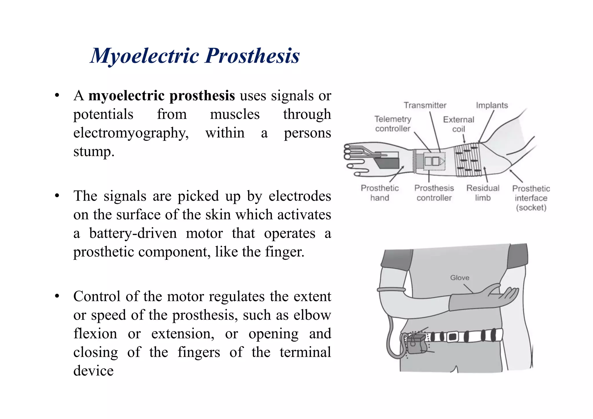 Prosthesis | PDF