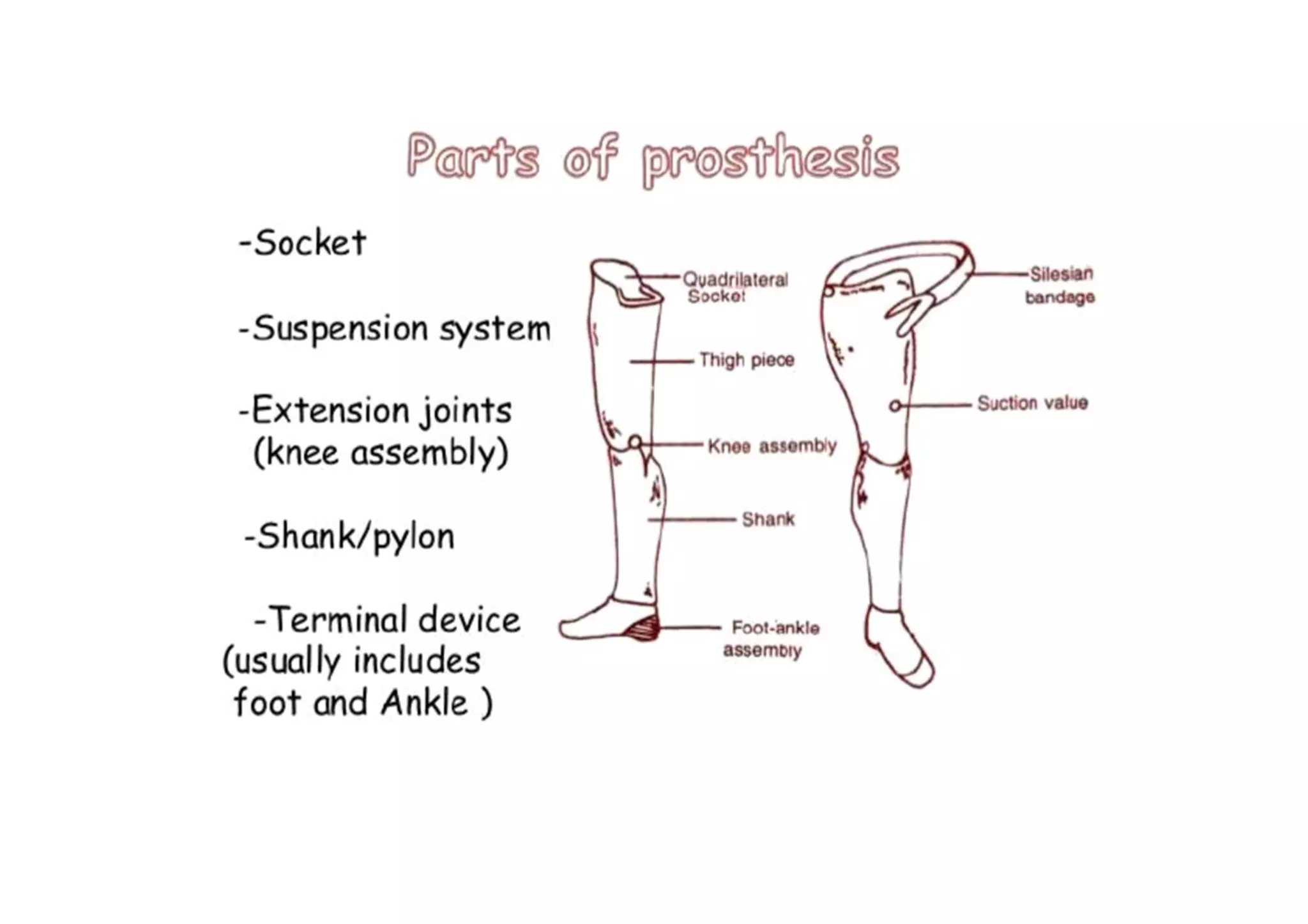 Prosthesis | PDF