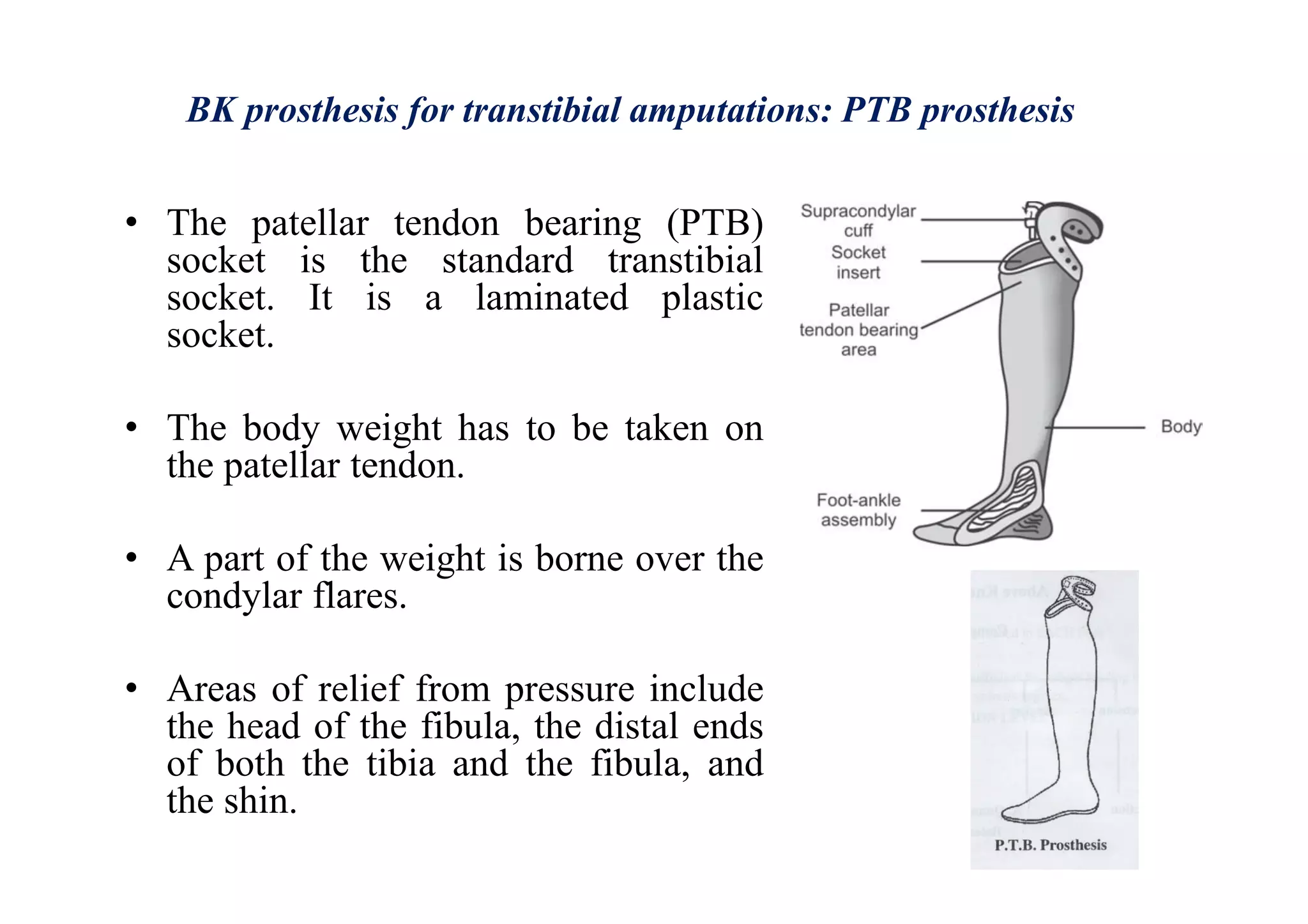 Prosthesis | PDF