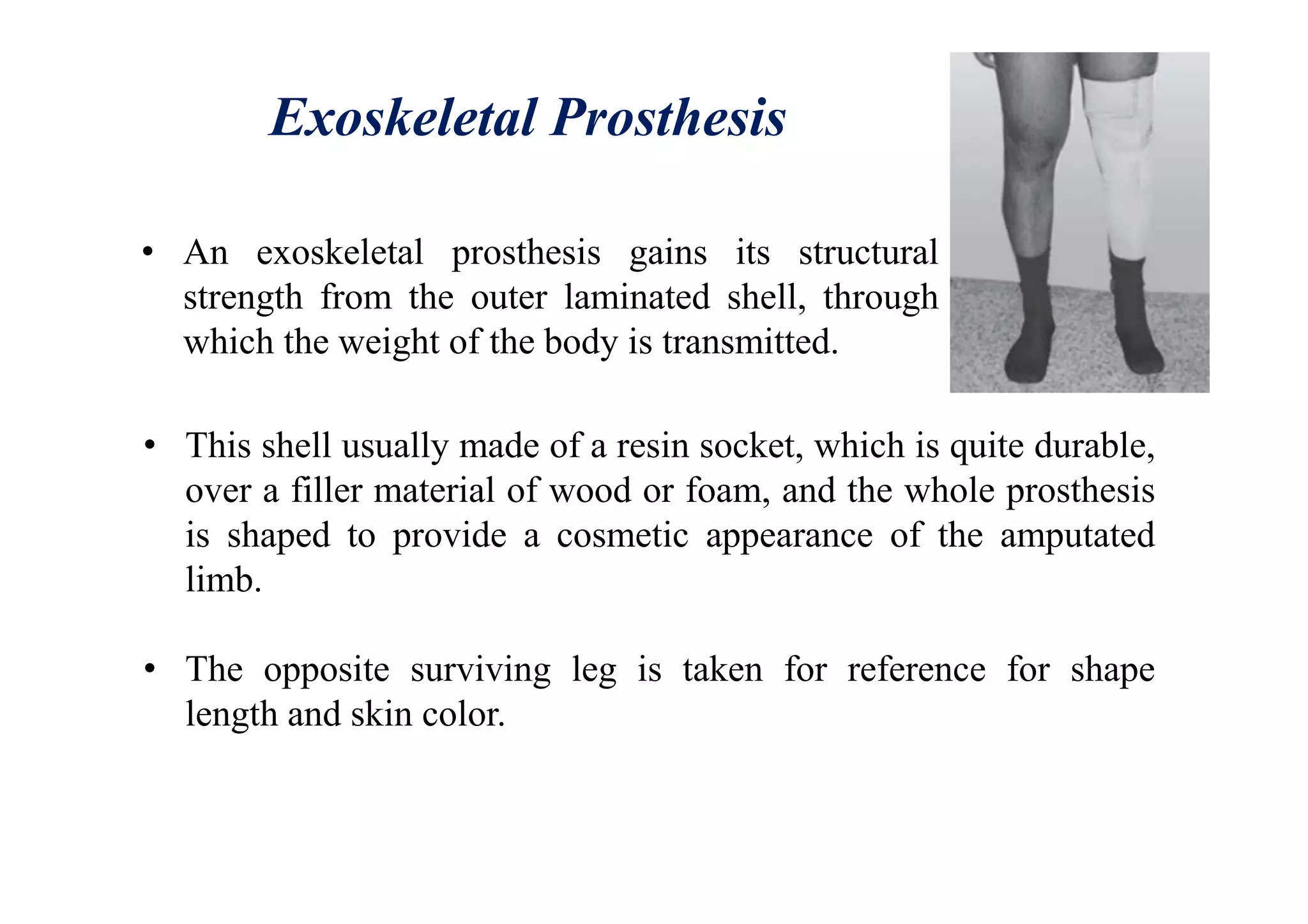 Prosthesis | PDF