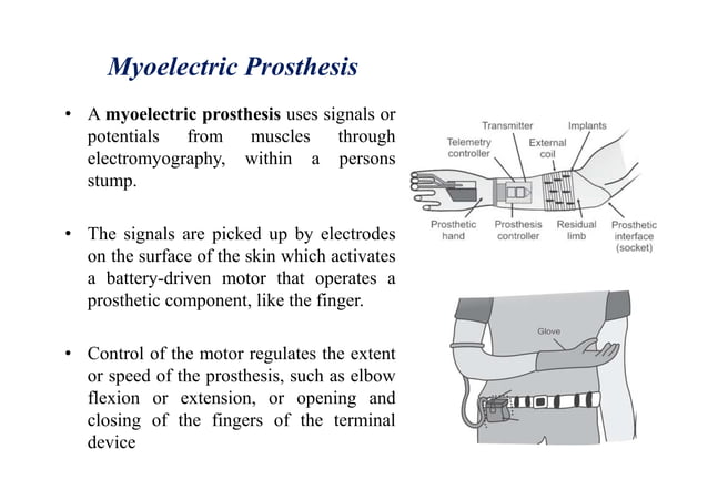 Prosthesis | PDF