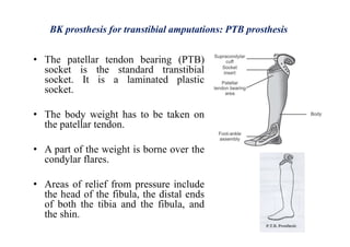 Prosthesis | PDF