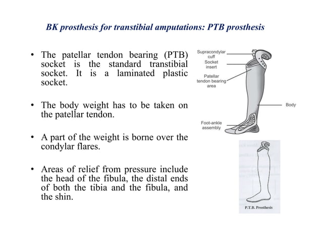 Prosthesis | PDF