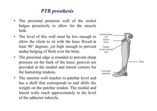 Prosthesis | PDF