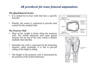 Prosthesis | PDF