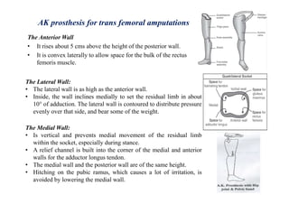 Prosthesis | PDF