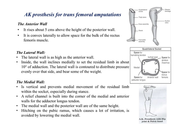 Prosthesis | PDF