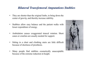 Prosthesis | PDF