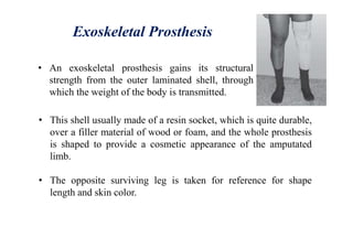 Prosthesis | PDF
