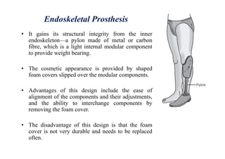 Prosthesis | PDF
