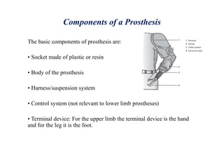 Prosthesis | PDF