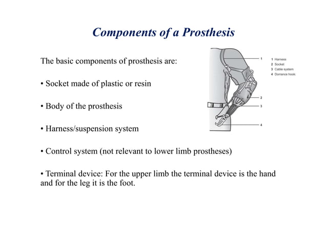 Prosthesis | PDF
