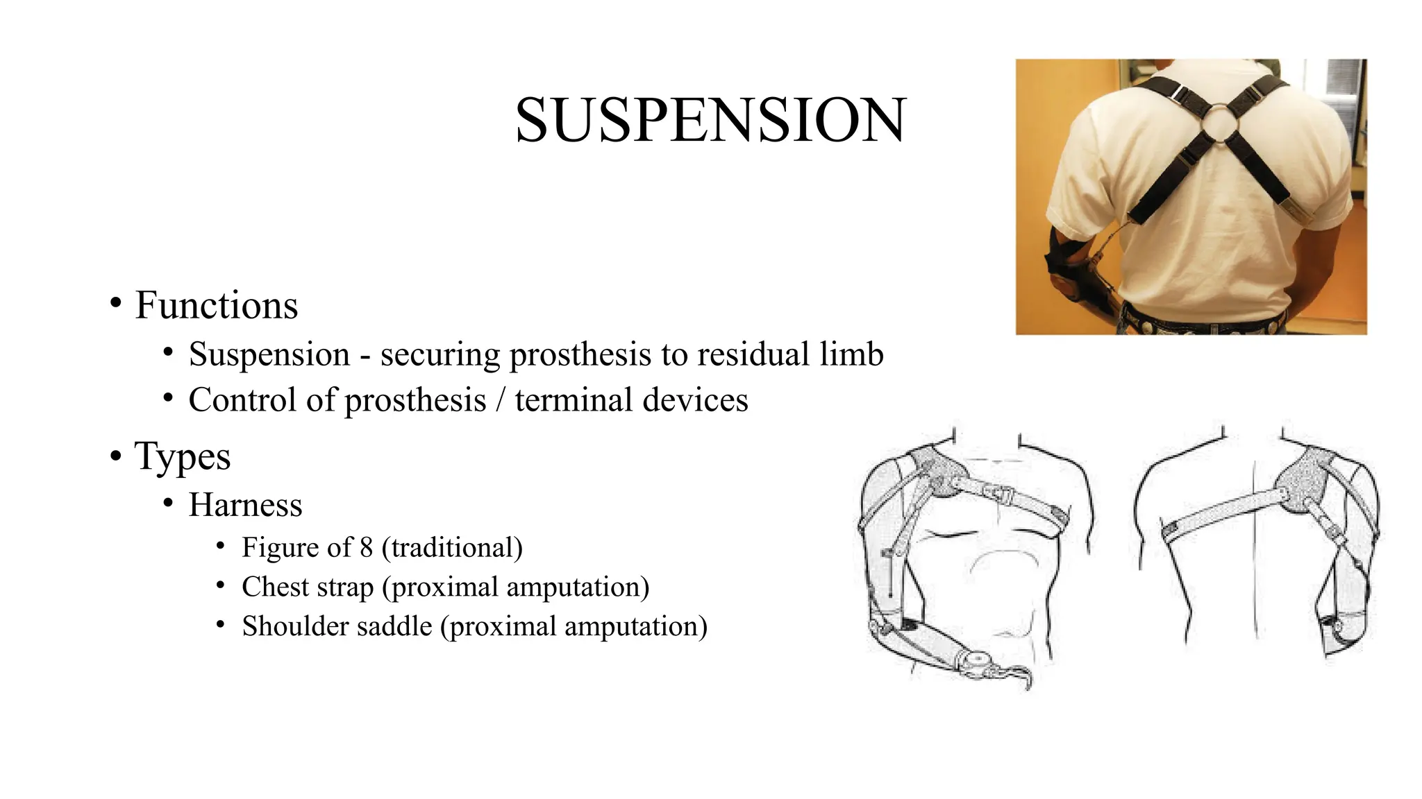 PROSTHESIS - PHYSIOTHERAPY REHABILITATION | PPTX