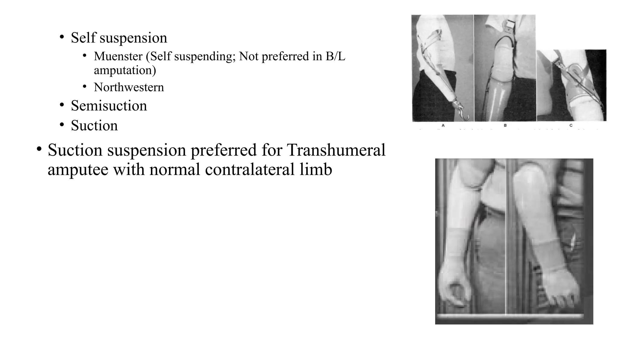 PROSTHESIS - PHYSIOTHERAPY REHABILITATION | PPTX