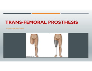 Prosthesis 15. Transfemoral Prosthesis.pdf