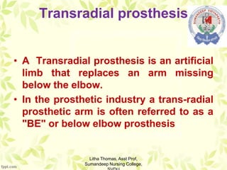 Prosthesis and Crutch walking | PPTX