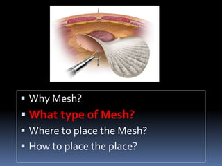 Prosthesis and fixation device | PPTX | Death, Injury, or Military ...