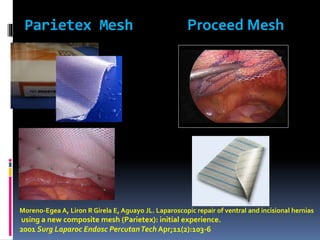 Prosthesis and fixation device | PPTX | Death, Injury, or Military ...