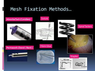 Prosthesis and fixation device | PPTX | Death, Injury, or Military Conflict | Sensitive Topics