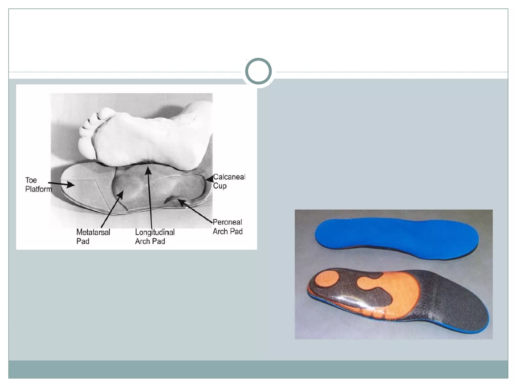 Prosthesis and orthotics | PPT