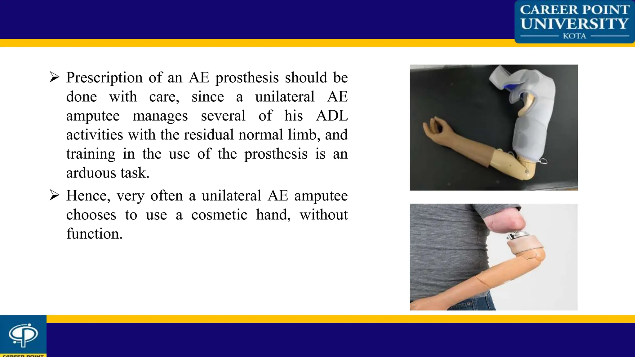 Prosthesis upper limb and lower limb.pptx