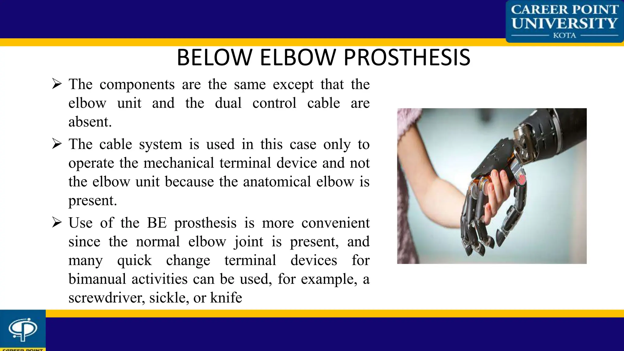 Prosthesis upper limb and lower limb.pptx