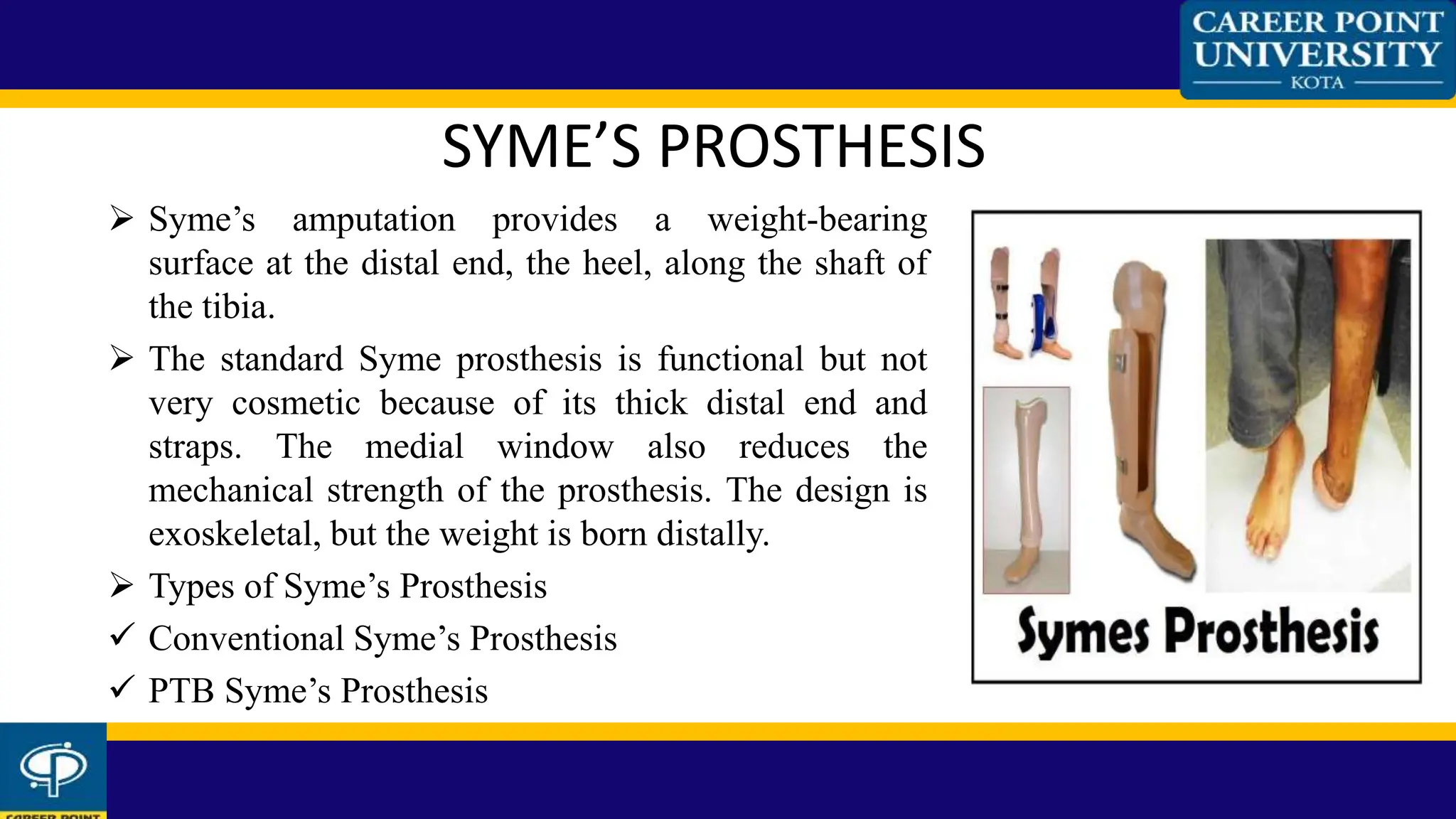 Prosthesis upper limb and lower limb.pptx