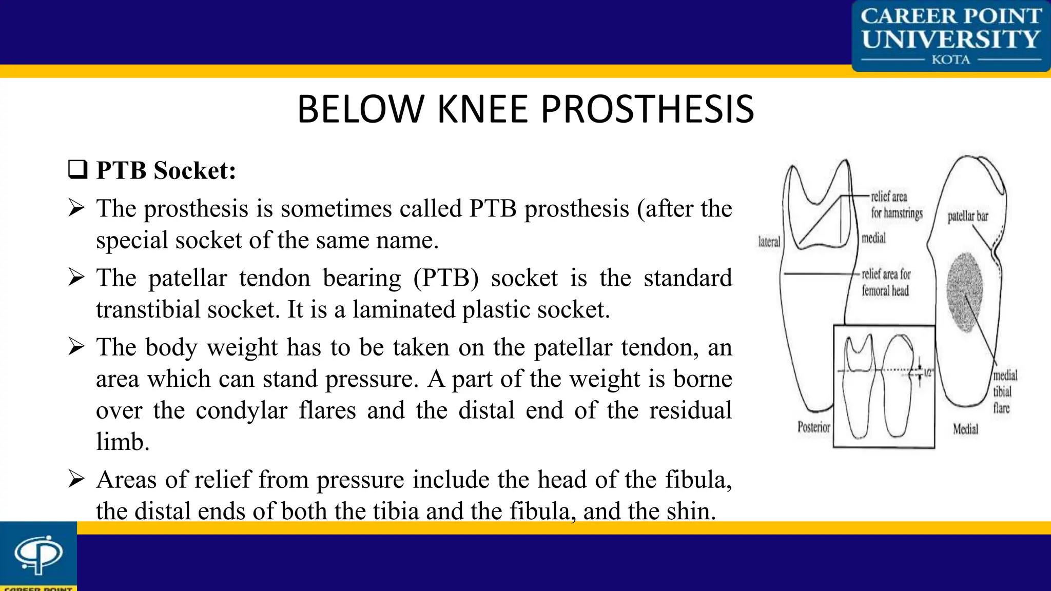 Prosthesis upper limb and lower limb.pptx