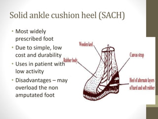 Lower Limbs Prosthesis | PPTX