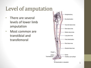 Lower Limbs Prosthesis | PPTX