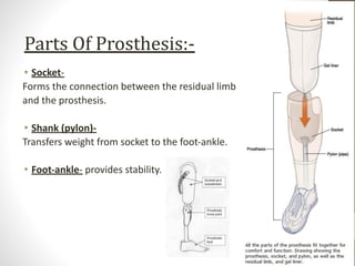 PROSTHESIS_REHABILITATION for foot lecture for dpt studentsts | PPT