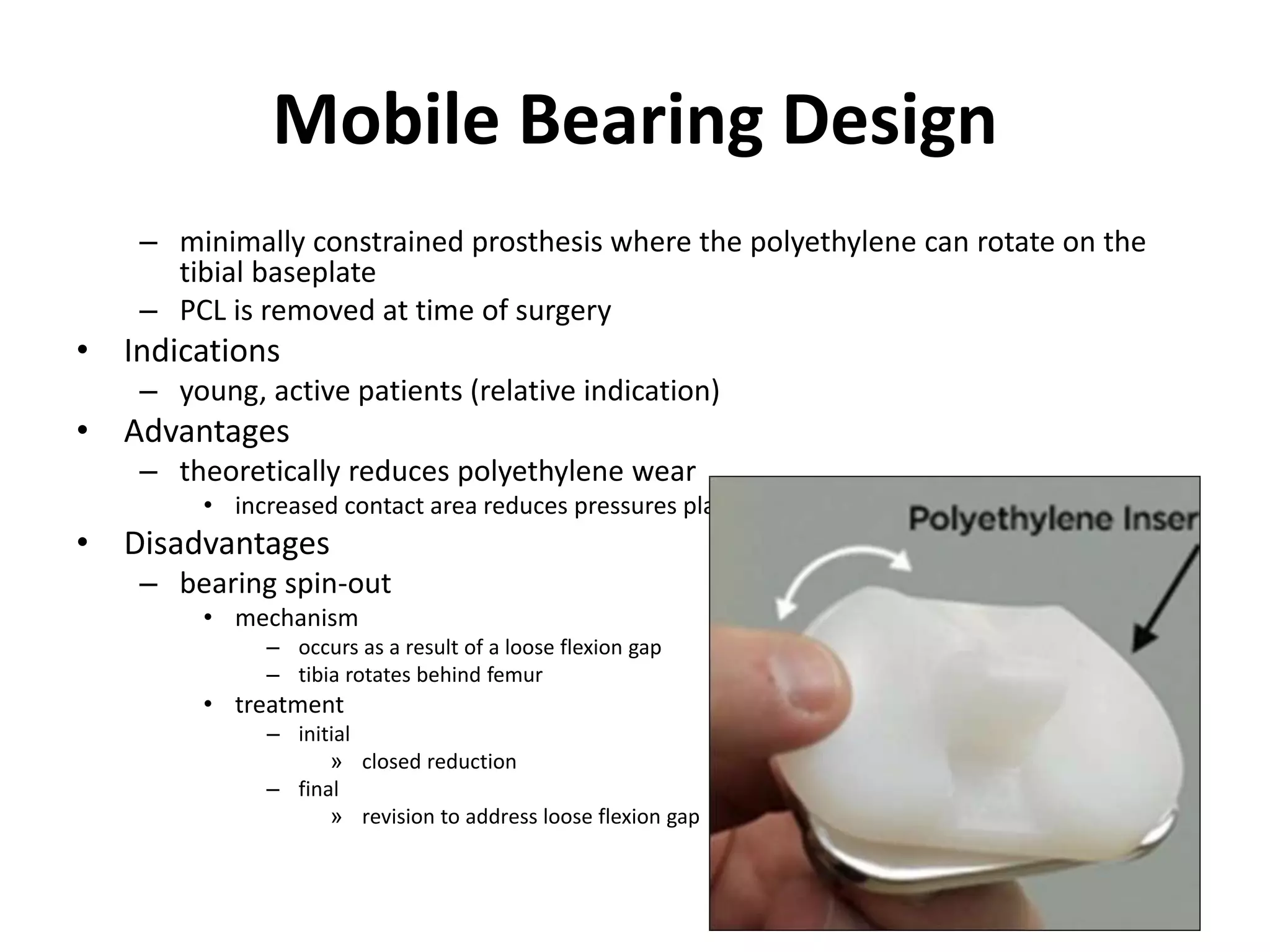 Prosthesis selection | PPTX
