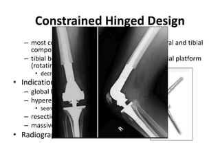 Prosthesis selection | PPTX