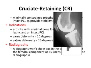 Prosthesis selection | PPTX