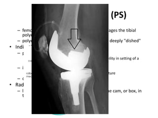 Prosthesis selection | PPTX