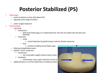 Prosthesis selection | PPTX