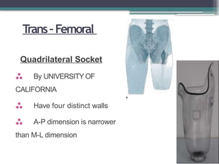 Prosthesis in orthopaedics details about various upperlimb and lower ...