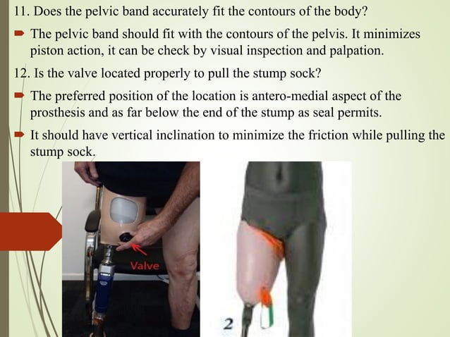 LOWER LIMB PROSTHETIC CHECKOUTS | PDF
