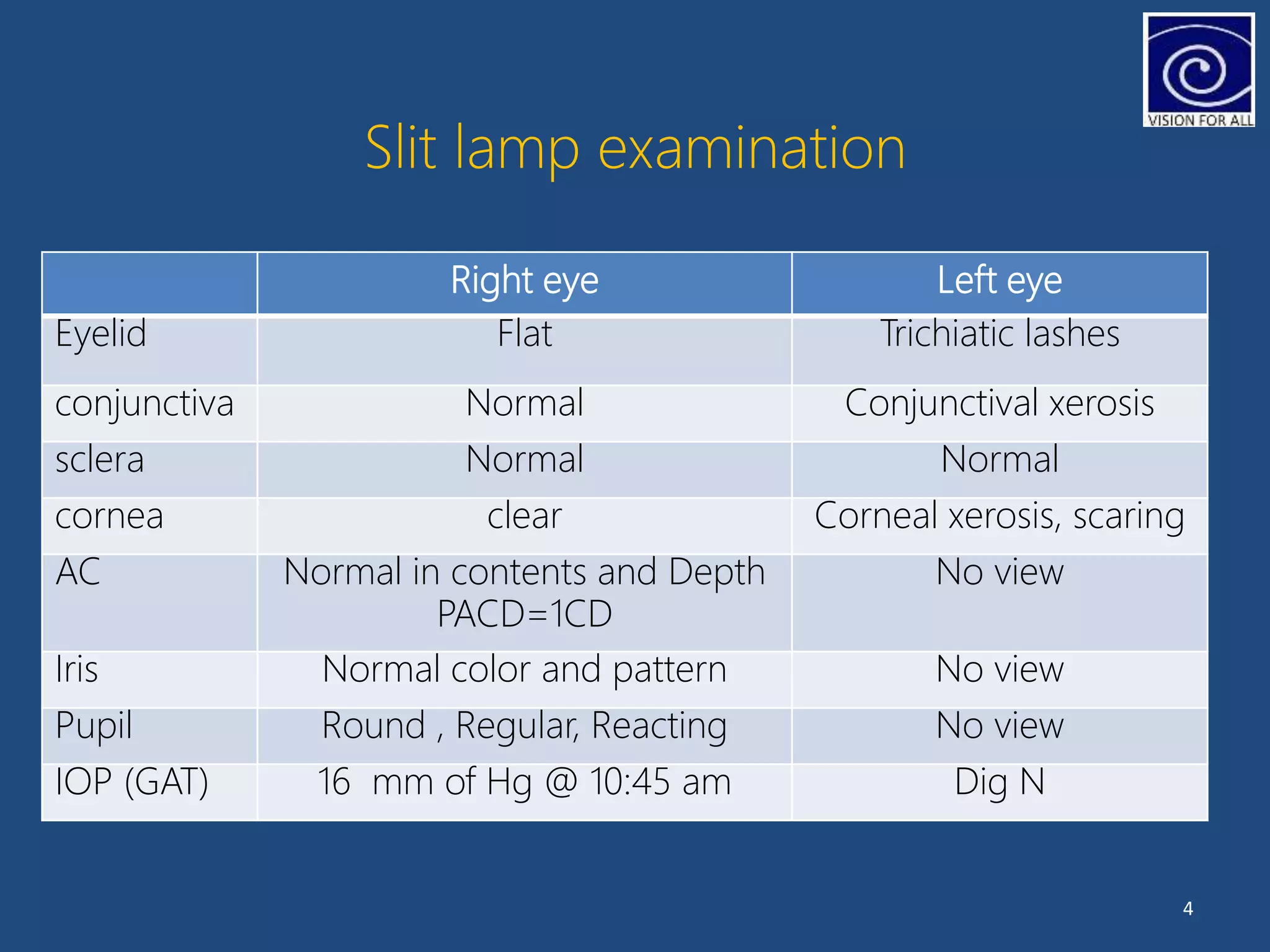 Prosthetic Contact Lens (Grand round) | PPTX