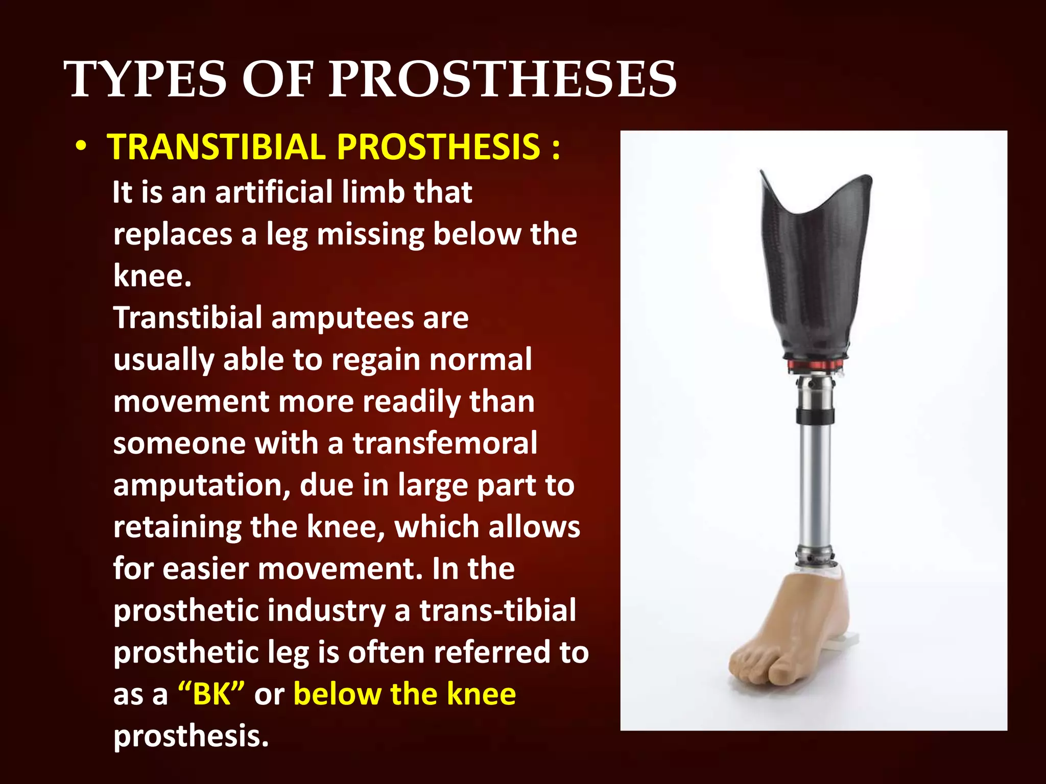 Prosthetic devices | PPTX
